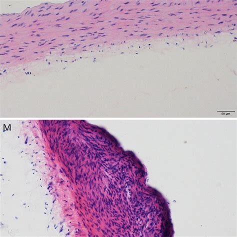 The Morphology Of Aorta By He Staining Download Scientific Diagram