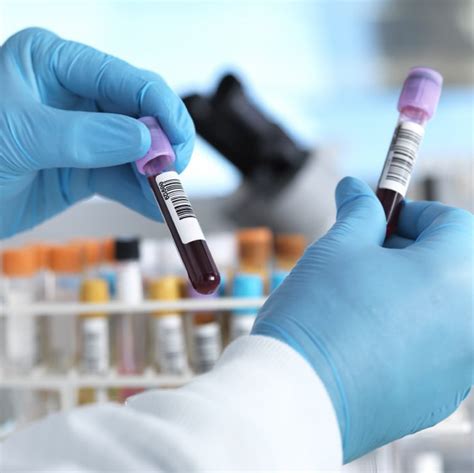 Torch Profile Essa Laboratory Essalaboratory