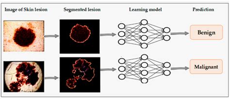 Figure 5 From Skin Cancer Detection Using Convolutional Neural Network Semantic Scholar