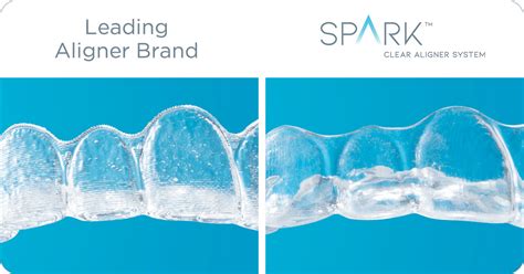 Spark™ Clear Aligners Maryland Advanced Orthodontics Gaithersburg Md