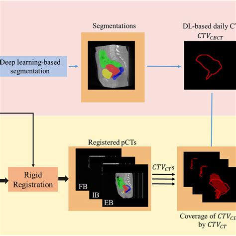 Examples Of Segmentation On Cbct The Contours Are Represented On The