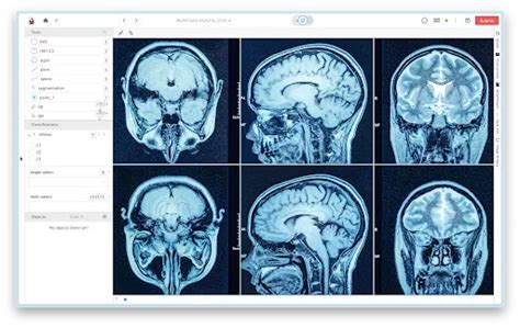 Efficiently Annotating Multi Dicom Assets Simplifying Medical Ai Workflows With Ango Hub Imerit