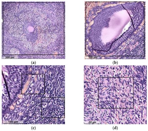 Diagnostics Special Issue Lesion Detection And Analysis Using Optical Imaging