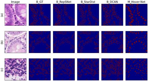 Repsnet A Nucleus Instance Segmentation Model Based On Boundary