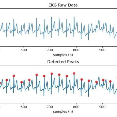 Electrocardiogram Signal Data And Qrs Complex Peaks Detected After All Download Scientific
