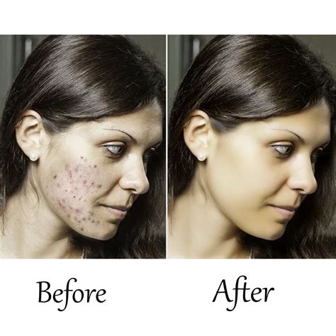 Remove Person From Photo Photo Manipulation Photo Retouch Combine Photos Photo Editing