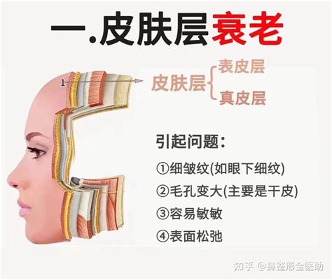 脸部衰老全解 知乎