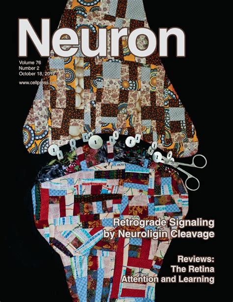 Issue Neuron