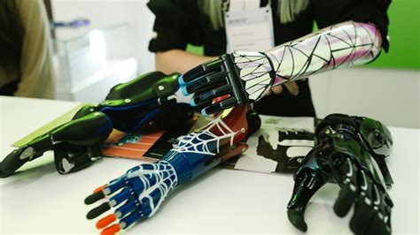 Роману Костомарову показали инновационные российские протезы вот как они выглядят