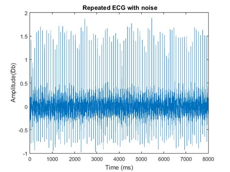ECG Repeated X And With Random Noise Added Download Scientific Diagram