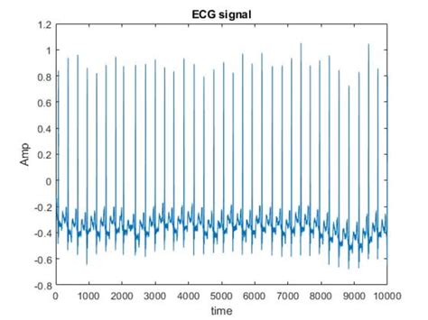 Matlab Based Digital Signal Processing Project Upwork