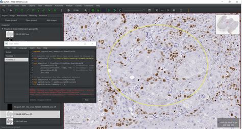 Tensorflow Installation Issue With Qupath 040 Image Analysis Imagesc Forum