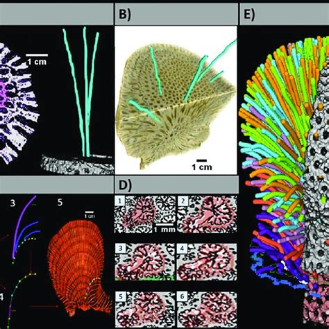 Segmentation Process Of Polyp Routes A Left Slice D Image Of Download Scientific Diagram