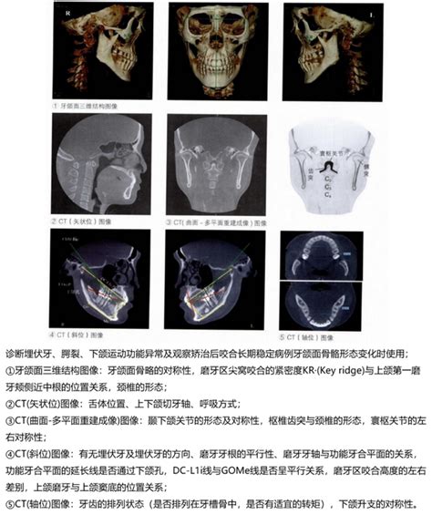 正畸学堂 干货！口腔正畸临床诊断要点 知乎