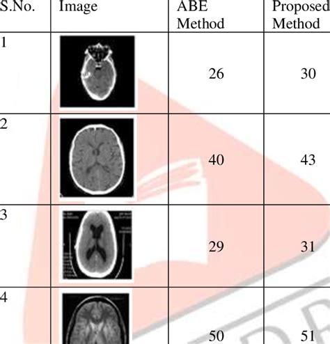Represents Psnr Values Of Ct Scan Abe Algorithm Vs Proposed Algorithm