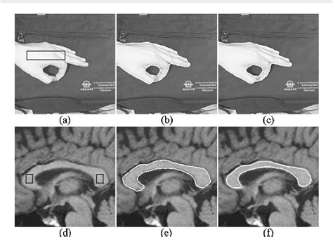 figure 1 from boundary based image segmentation using binary level set