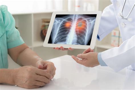 Mesothelioma Diagnosis Pintas And Mullins