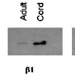 Immunoprecipitation Of PLC Isoforms From Adult And Cord T Cells PLC Download Scientific