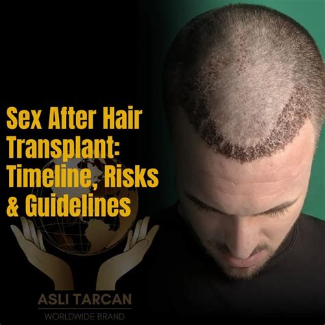 When Can You Have Sex After Hair Transplant Is It Safe