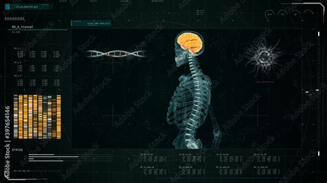 Patients Brain Scan On Screen Dna Research Genetic Disorder