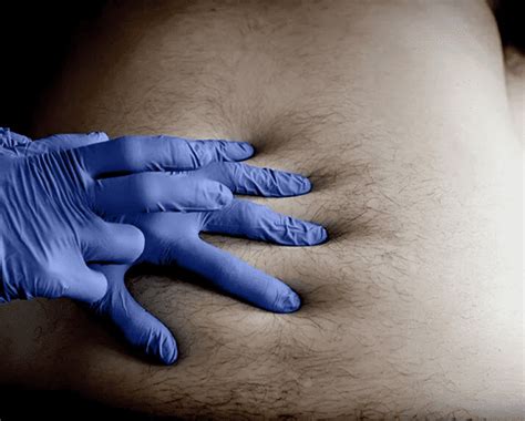 Eus Endoscopic Ultrasound