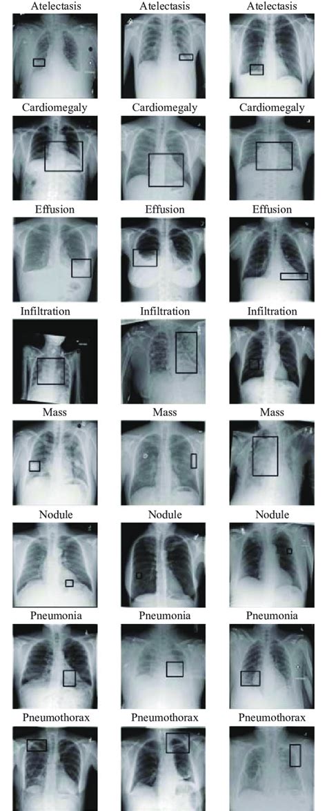 Visualization Of Samples With Ground Truth Bounding Boxes Across Sample