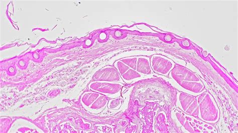 Cross Section Of Human Skeletal Muscle Filmed Under Microscope 400x Against Bright Field Stock
