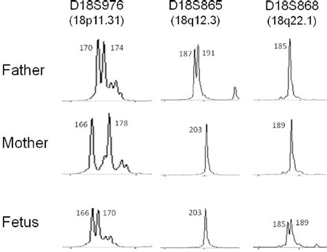 What Is Dna Marker Analysis At Anthony Bohnsack Blog