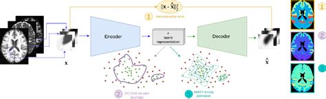 Brain Subtle Anomaly Detection Based On Auto Encoders Latent Space