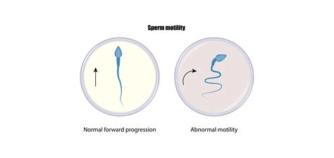Low Sperm Motility Ekam