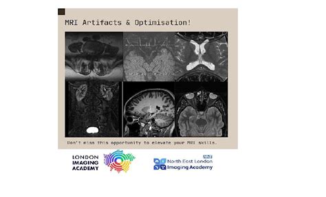 Mri Artefacts And Optimisation May 1 2024 Online Event Allevents