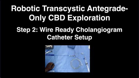 Step 2 Wire Ready Cholangiogram Set Up Robotic Cbd Exploration