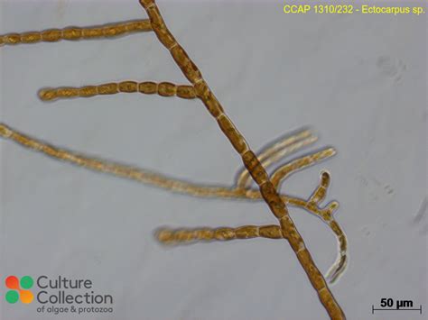 Ectocarpus Under Microscope Labeled
