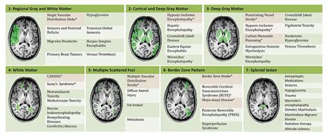 Stroke Differential Diagnosis And Mimics Part 1 Applied Radiology