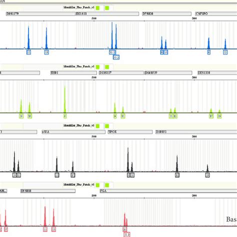 Pdf A Suitable Method For Dna Extraction From Bones For Forensic