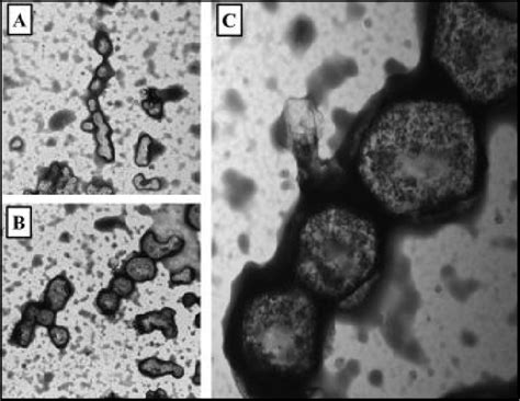 An Electron Micrograph Of A Smear Of Fried Shape Colony Of Spiroplasma