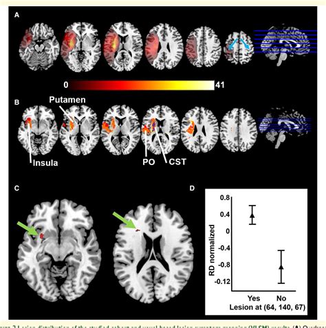Table 1 From Motor Inhibition And Its Contribution To Recovery Of