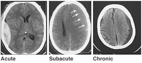 A Systematic Approach To The Interpretation Of Ct Head