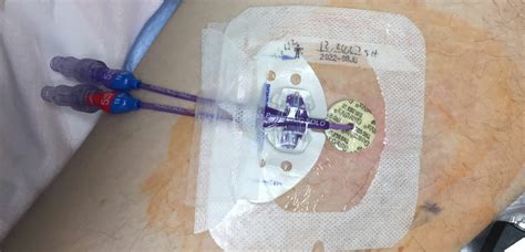 PICC Line And Midline Catheter Care Vascular Wellness