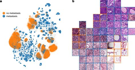 Figure From Self Supervised Visualisation Of Medical Image Datasets Semantic Scholar