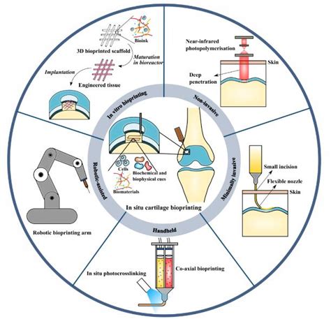 机械手臂式原位生物3d打印在软骨组织工程中的运用 3d科学谷