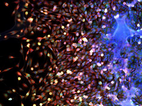 Assays Using Multi Parameter Flow Cytometry