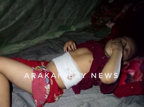 မောင်တောတွင် ၅ နှစ်အရွယ် ကလေးငယ် ၁ ဦး စနိုက်ဘာကျည် ထိမှန် ဒဏ်ရာရ၊ မောင်တောတိုက်ပွဲ ဆက်လက်ပြင်းထန