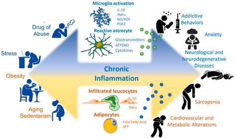 IJMS | Free Full-Text | Central and Peripheral Inflammation: A Common ...
