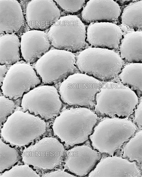 Fat Cells From Adipose Tissue Sem Stock Image Science Source Images