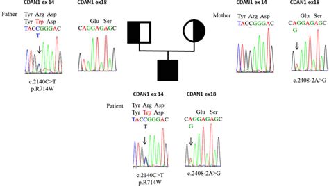 The Electropherograms Indicate Compound Heterozygous Cdna1 Mutations