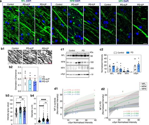 Neurofilament Abnormalities In The White Matter Underlying The Motor Download Scientific