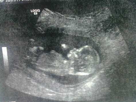 Abcs Of Life Looking For Ideas For Our Sex Finding Out Partyto Be