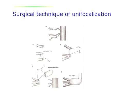 Ppt Surgical Treatment Of Pa With Vsd Withoutwith Mapca Powerpoint