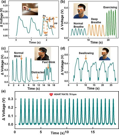Real Time Dynamics Of Ftep In Physiological Signal Monitoring A Download Scientific Diagram